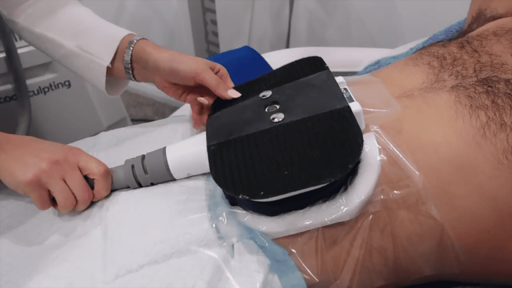 Coolsculpting Sydney [ Fat Freezing Clinic ] Chin-Thighs-Love Handles